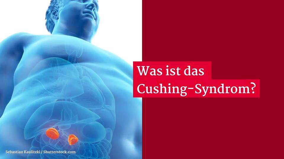 Gesundheitslexikon: Was ist das Cushing-Syndrom? | RTL.de